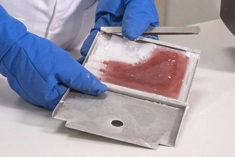 The Importance of Cryopreservation in Regenerative Medicine - OriGen ...